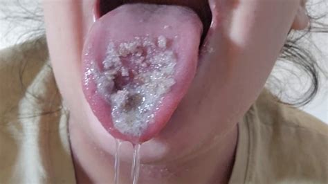 Drolling Mouthplay Fizzy Lollipop And Spit Explosion Abigaillatinaa