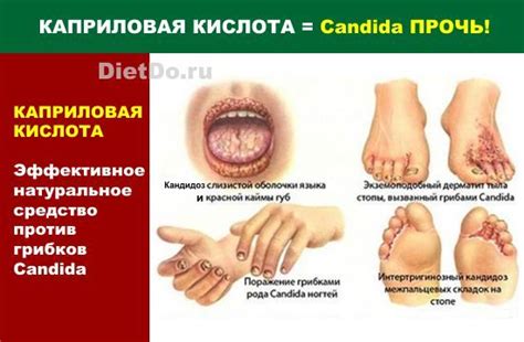 Масло МСТ: что это, отзывы, польза и вред, как принимать, какое лучше ...