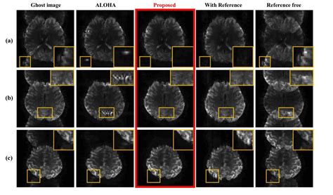 K Space Deep Learning For Reference Free Epi Ghost Correction Deepai