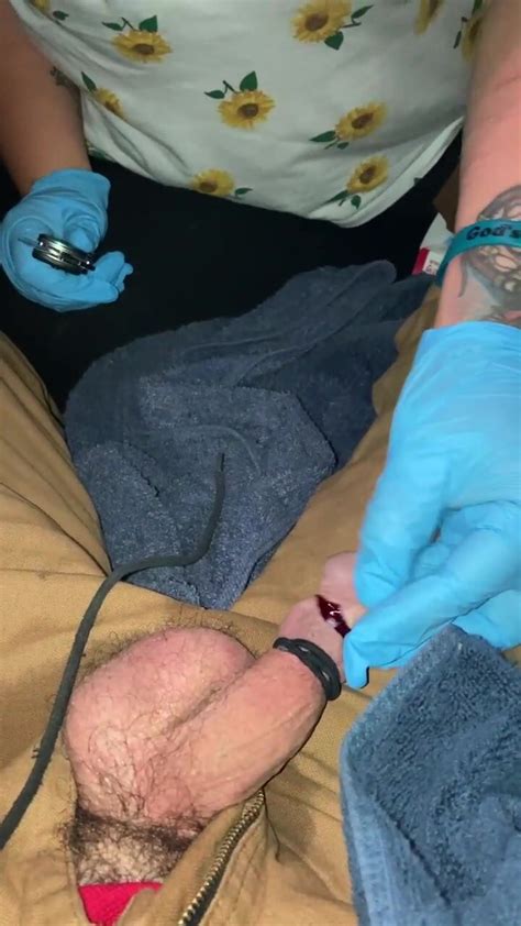 Woman Cuts Off Dickhead Glansectomy