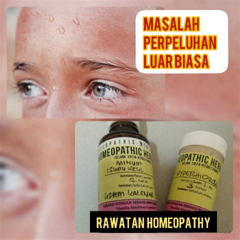 HOMEOPATHY HERB2U Online Shop Shopee Malaysia
