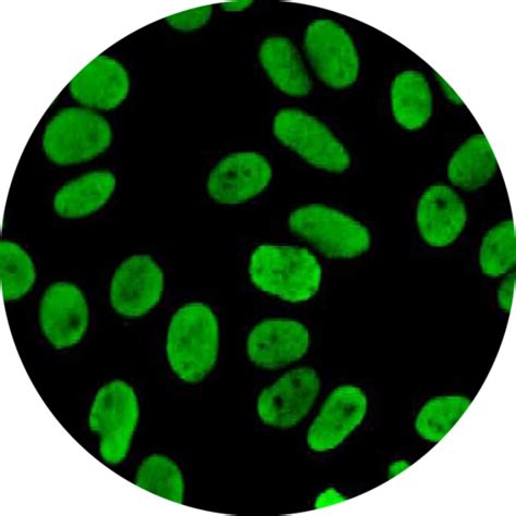 Immuno Concepts Somagen Diagnostics