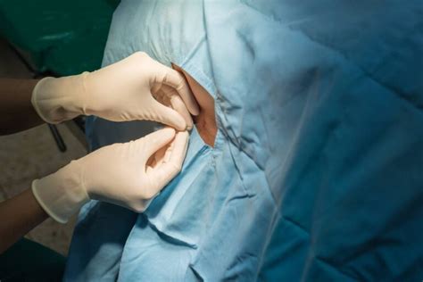 Virginia Anesthesia Services LLC The Effect Of Baricity On Spinal Anesthesia Virginia