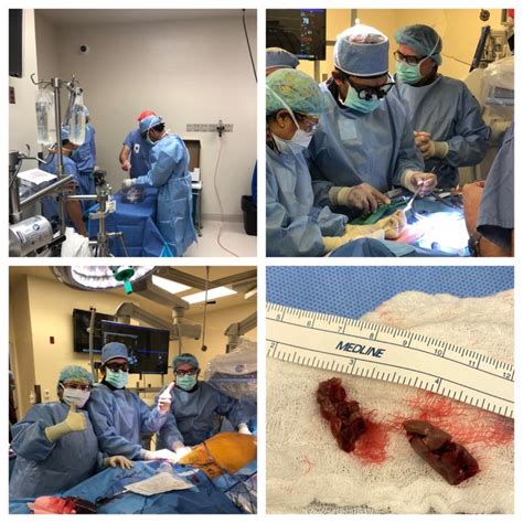 We Did Our First Angiovac Case Today And It Was Absolutely Rewarding