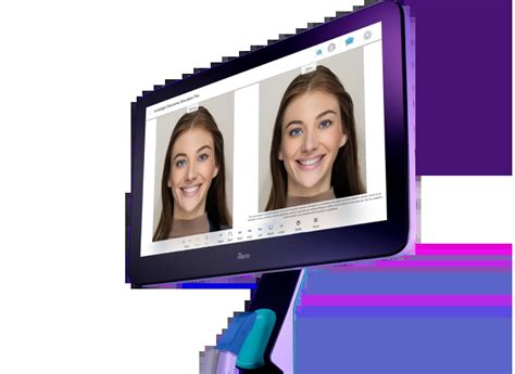 Dental Practice Growth Starts With ITero Intraoral Scanners ITero