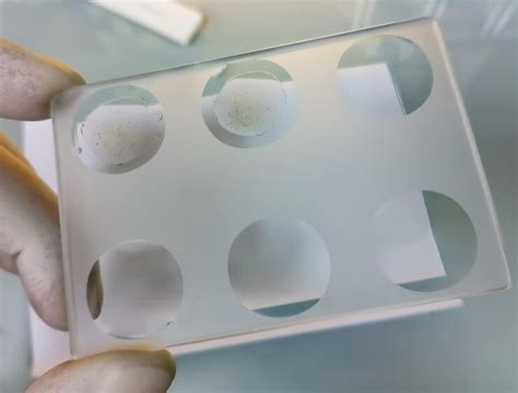 Premium Photo Rpr Vdrl Syphilis Test Glass Slide Agglutination Method Treponema Pallidum