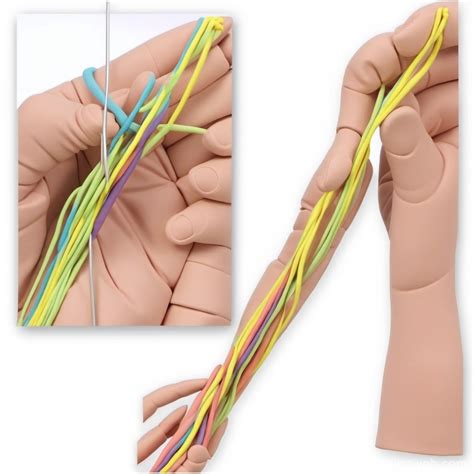 Brachial Plexus Stable Diffusion Online Brachial Plexus Stable Diffusion Online