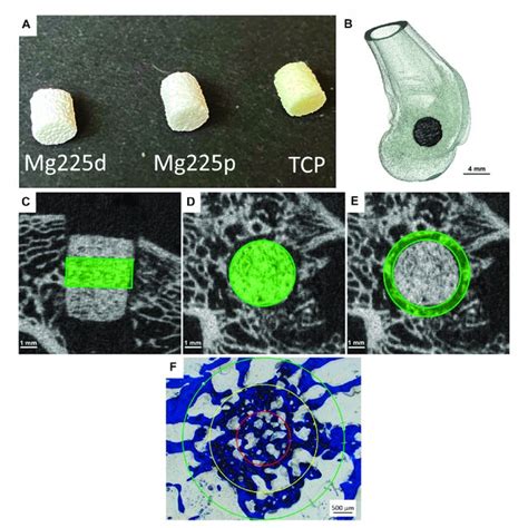 A Mg225d Mg225p And Tcp Scaffolds Prior To Implantation H 51 Mm Download Scientific