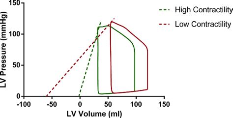 Intraventricular Pressure Volume Loops For Two Scenarios Of High E Es