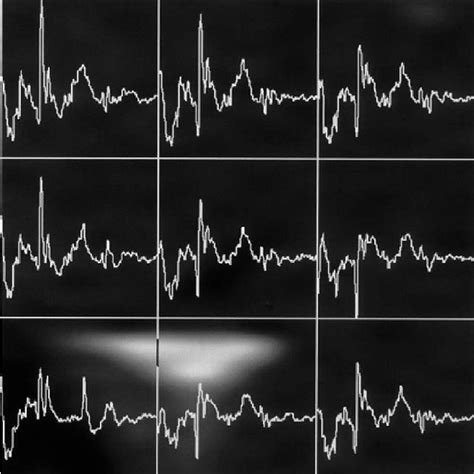 Comparison Of Single Vs Multi Voxel Techniques Download Table