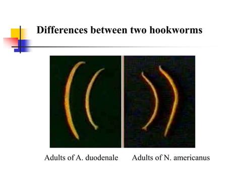Parasitology Hookworm Pptx Slides 1 Ppt