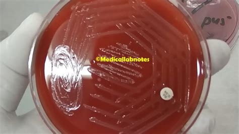 Streptococcus Agalactiae Introduction Morphology Pathogenicity