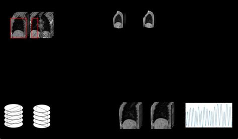 Overview Of The Procedure For Generating The 3d Synthetic Dataset The