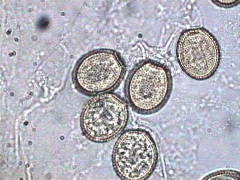 Allomyces ~ Detailed Information Photos Videos