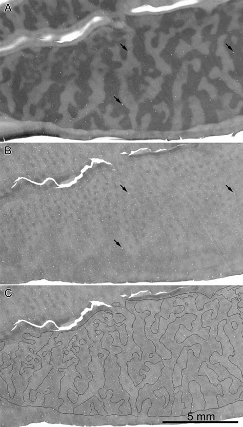 Ocular Dominance Columns In Strabismus Visual Neuroscience Cambridge Core