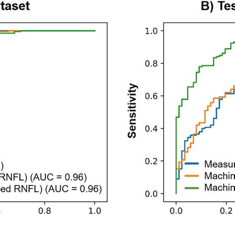 receiver operating characteristic curves comparing glaucoma detection
