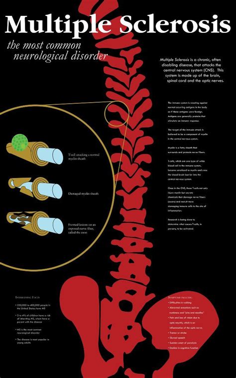 Multiple Sclerosis Ms Symptoms Early Signs Of Ms Artofit
