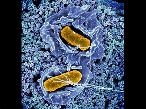 Doxycycline Inducible Gene Switch System For Bacteria Mediated Cancer Therapy Bioworld