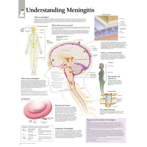 Scientific Publishing Understanding Meningitis Chart Laminated Or Paper
