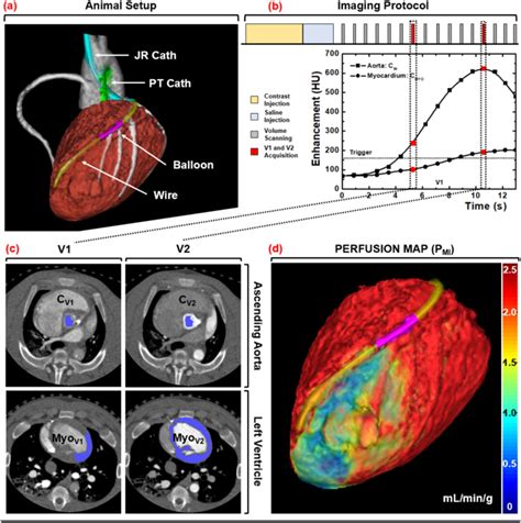 无需图像配准的动态 Ct 心肌灌注 Scientific Reports X Mol