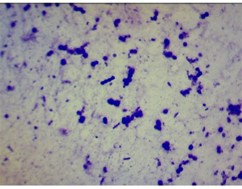 Gram Positive Streptococcus Quiz