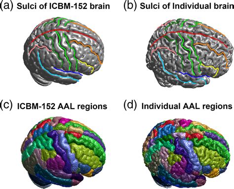 Parcellation Of Individual Brains According To The Automated Anatomical