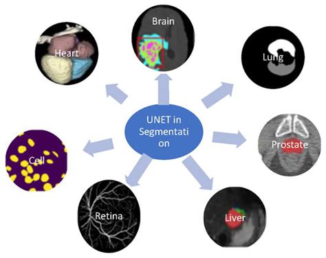Review Of Semantic Segmentation Of Medical Images Using Modified Architectures Of Unet Bohrium