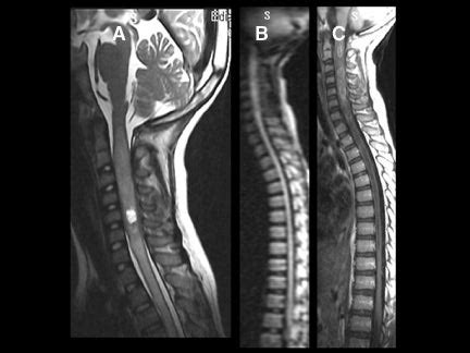 Diffusion Imaging In The Spine Applied Radiology