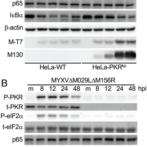 Activation Of The Nf κb Pathway After Intermediate Inhibition Of Pkr By