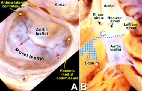 Mitral Valve Heart Diagram Structure Of The Heart Valves Ana