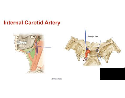 Internal Carotid Artery Quiz