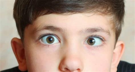 Top Causes Of Eye Problem