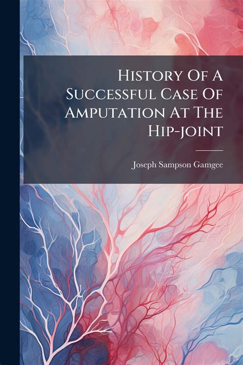 Buy History Of A Successful Case Of Amputation At The Hip Joint