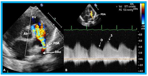 Echo Features Of Pda At Donald Zielinski Blog
