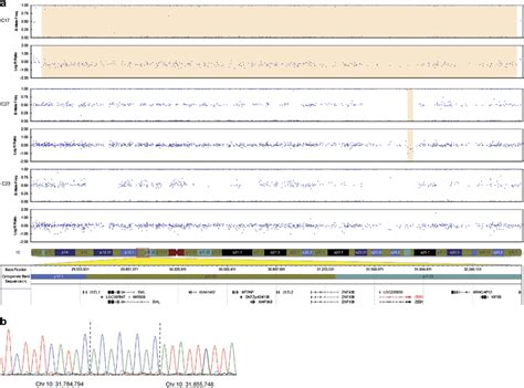 SNP Array CNV Analysis Of The ZEB Region In Probands With PPCD A A Download Scientific