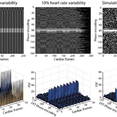 Different Undersampling Patterns And Corresponding Point Spread