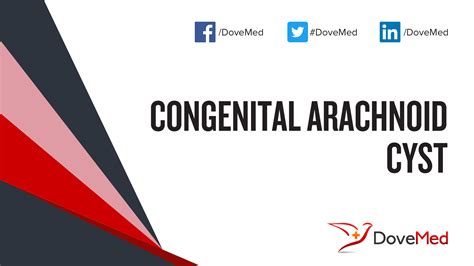 Congenital Arachnoid Cyst