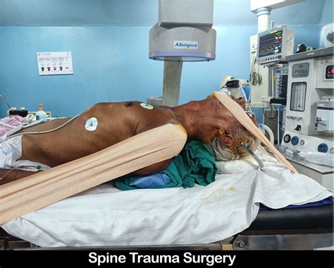 Spinal Fracture Fixation For Improved Quality Of Life