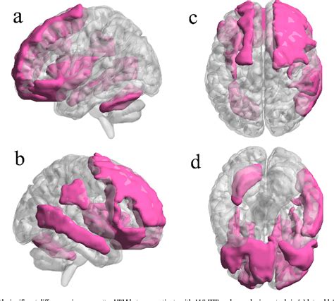 Table 1 From Graph Theory Network Analysis Provides Brain Mri Evidence