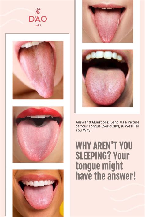 What Your Tongue Is Trying To Tell You About Your Health Artofit