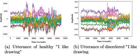 Mfcc Spectrogram Representing Healthy And Disordered 3 Word Sentence Download Scientific Diagram