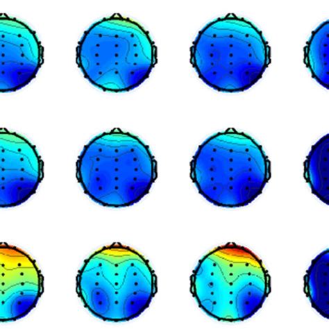 Scalp Topography Of Three Rois Under Four Kinds Of Selections From Left Download Scientific
