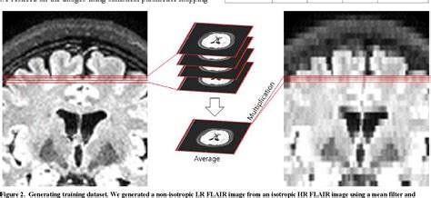Figure 2 From 3d Super Resolution For Non Isotropic Medical Image Through Multi Input 3d Resunet