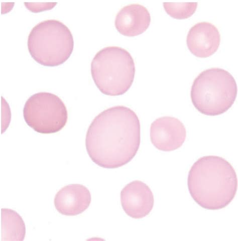 Eritrosit Berdasarkan Ukuran