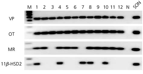 Single Cell Reverse Transcriptase Polymerase Chain Reaction Detection Download Scientific