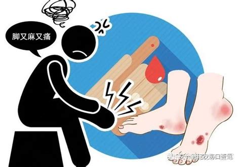 糖尿病患者脚疼是什么原因导致的 知乎