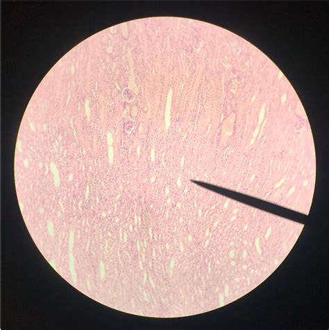 Renal Cortex And Medulla Histology Diagram Quizlet