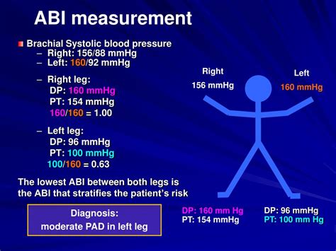 Ankle Brachial Index Nomtraveler