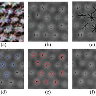 The Overall Framework Of The Tree Crown Detection For Large Scale Download Scientific Diagram