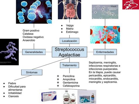 Streptococcus Agalactiae Alex Durán Udocz